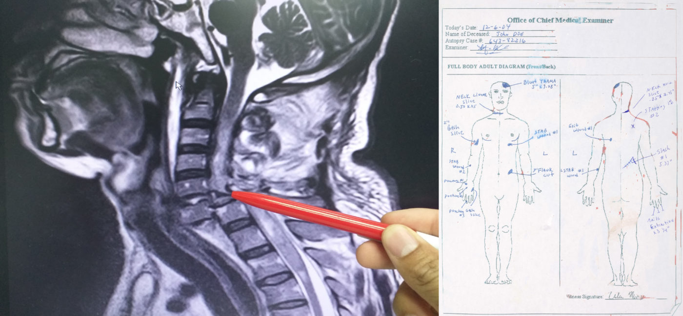 Biomechanical Analysis & Injury Review - Safety Research & Strategies, Inc.